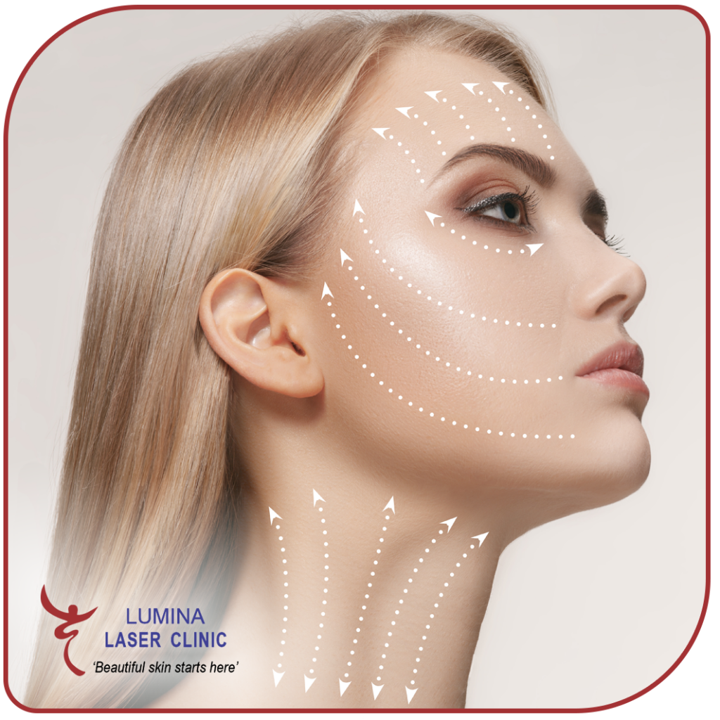 Plasma Skin tightenning - Lumina Laser Clinic